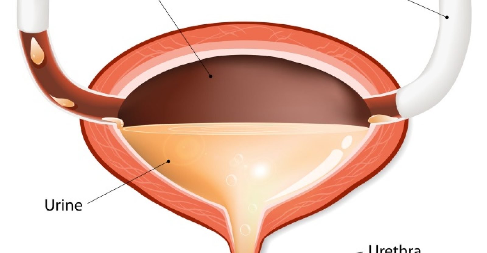 Cloudy Urine Causes and Natural Treatments - Well-Being Secrets